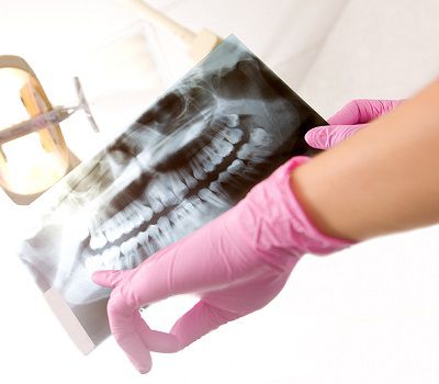 Dentist Apex, NC | Peak City Family Dentistry | Apex Dentist | Dentist 27502