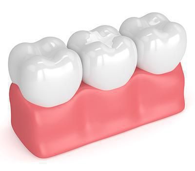 Dentist Woodland, California | Brian Lin D.D.S. | Woodland, CA Dentist ...