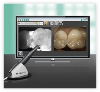 Technology | Sheffield Square Dental Care Chicago, IL