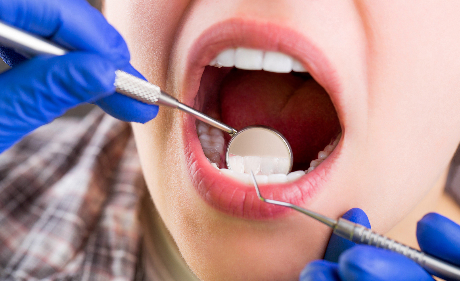 How important are professional teeth cleaning sessions? | Red Rock ...