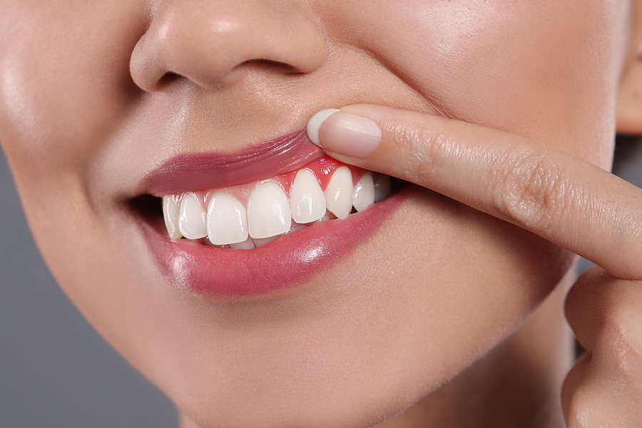 Periodontics: Treatments and Procedures | Arden Dental Center Wheaton, IL