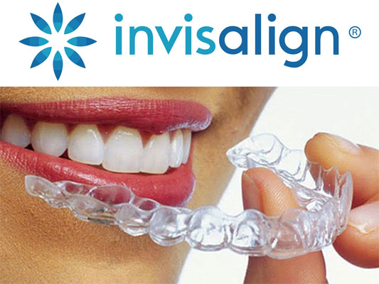 Things to Know About Invisalign | Northeast Dental Associates Humble, TX