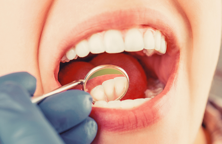 Don't Ignore These 5 Warning Signs: When to Consider a Root Canal | 4th ...