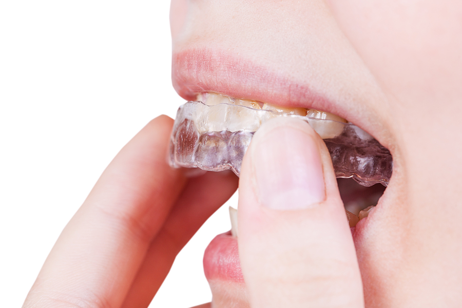 What Can You Drink During Your Invisalign® Treatment? | Pharr Road Dentistry Atlanta, GA