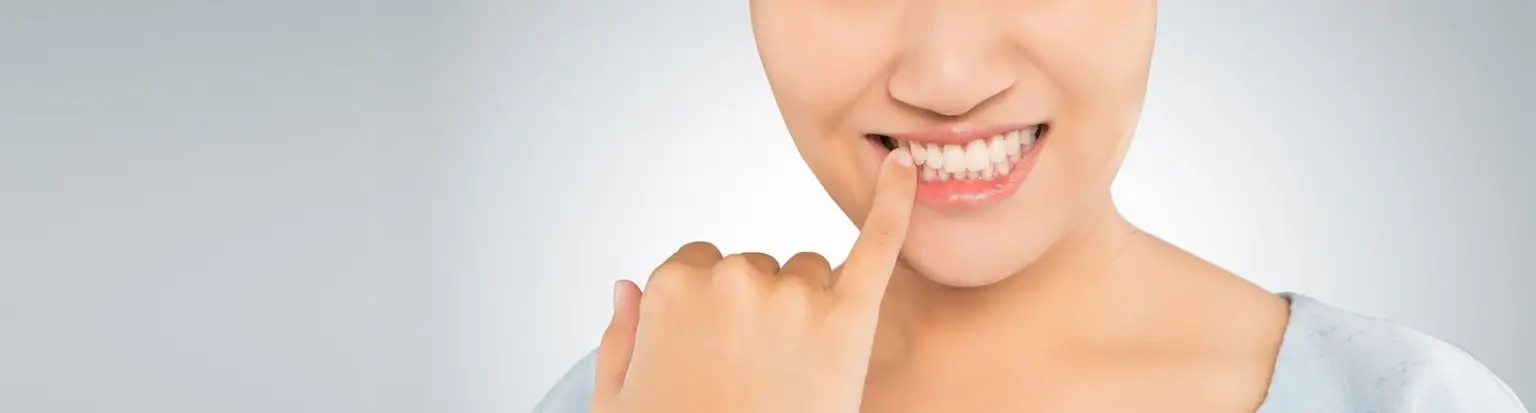 HOW CAN I FIX SMALL TEETH? | The Dental Centre Austin, TX