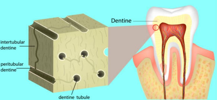 Risks of Root Canal Therapy | Seattle Dental Care Seattle, WA