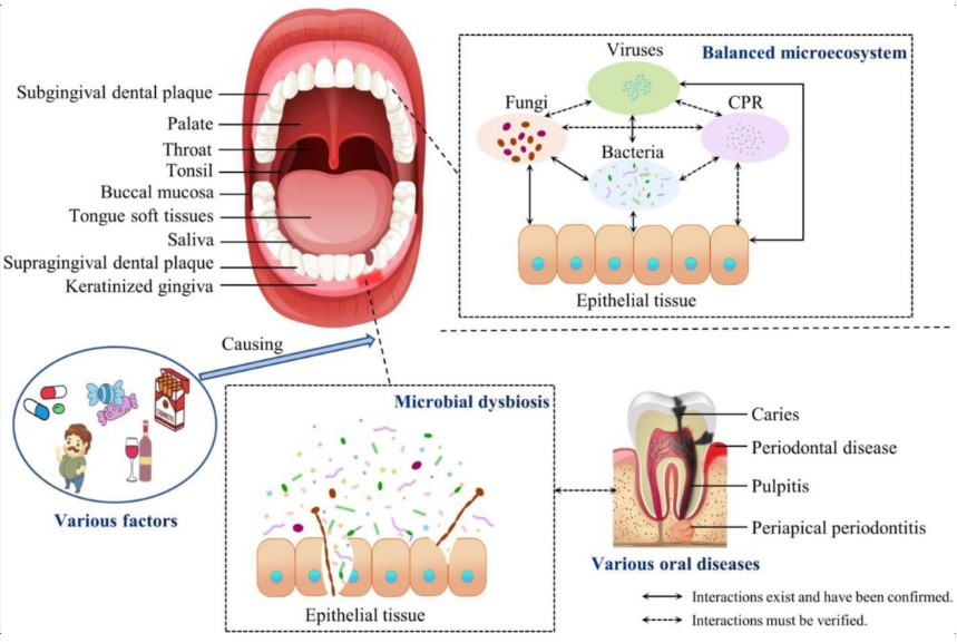 How to restore oral microbiome | Seattle Dental Care Seattle, WA