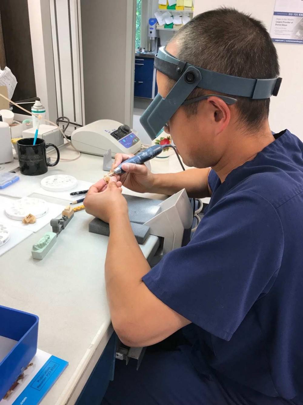 How to tell dental crowns or veneers are of high quality---Bitewing ...