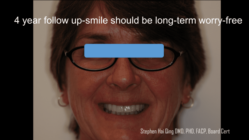 Implant-supported crown and bridge prosthesis—Pros and Cons, and ...