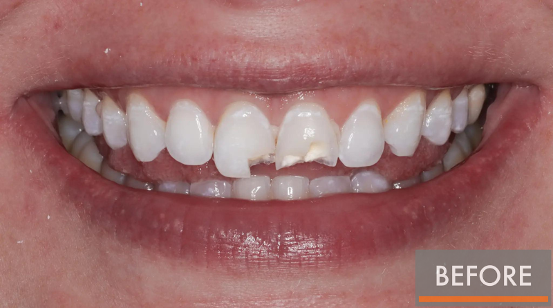 Smile Gallery | Charles Street Dental Boston, MA