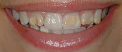 Smile Gallery | Emerald Peak Dental Anchorage, AK