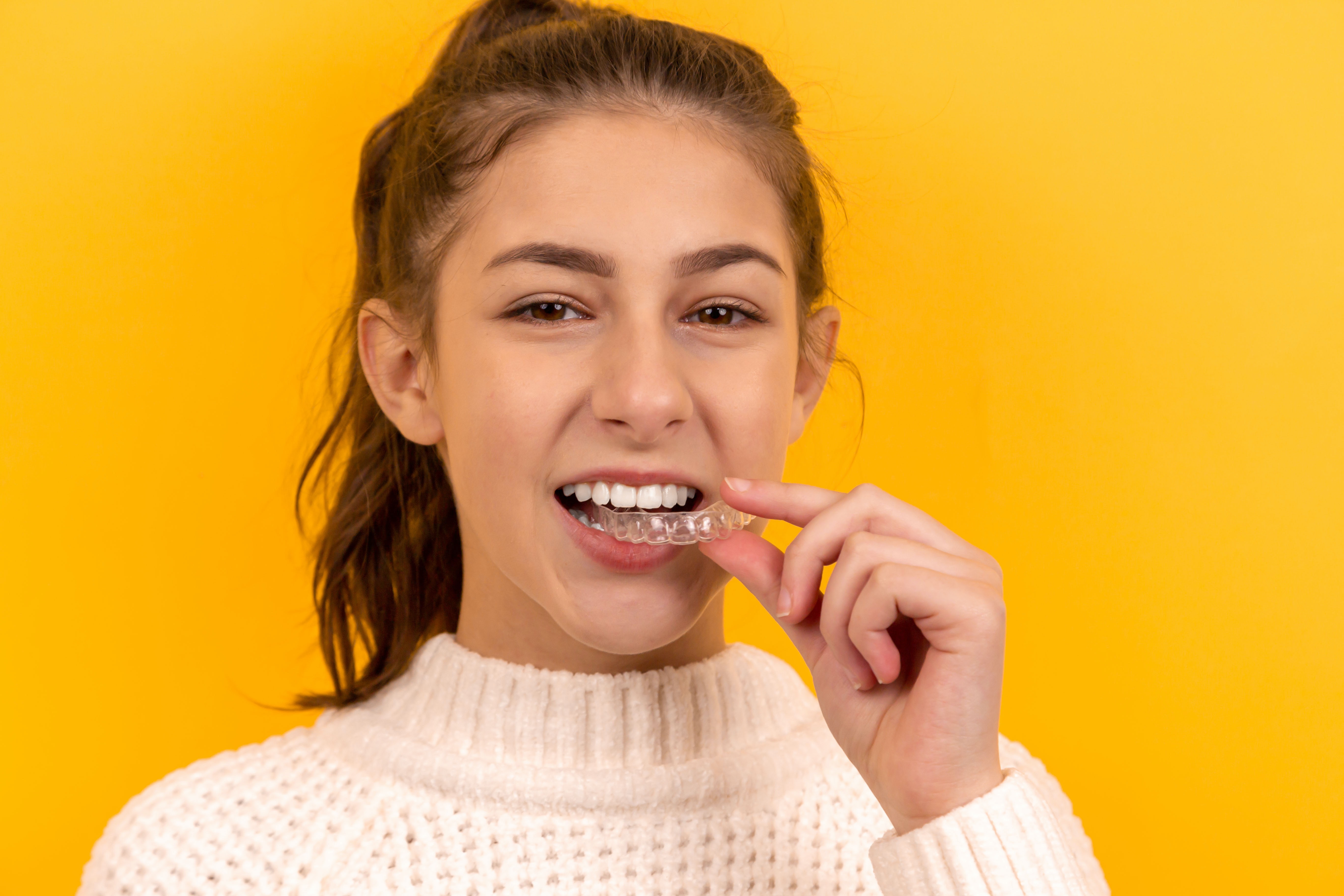 Invisalign Aligners and Their Impact on Confidence, Read Now