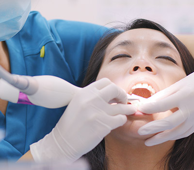 Deep Cleaning, Periodontal Scaling and Root Planing