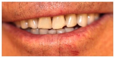 Dentist Agoura Hills, CA | Hilltop Dental by Dr. George Apelian ...