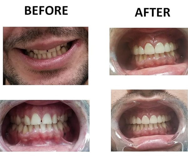 Smile Gallery | Consuela Zau Los Angeles, CA