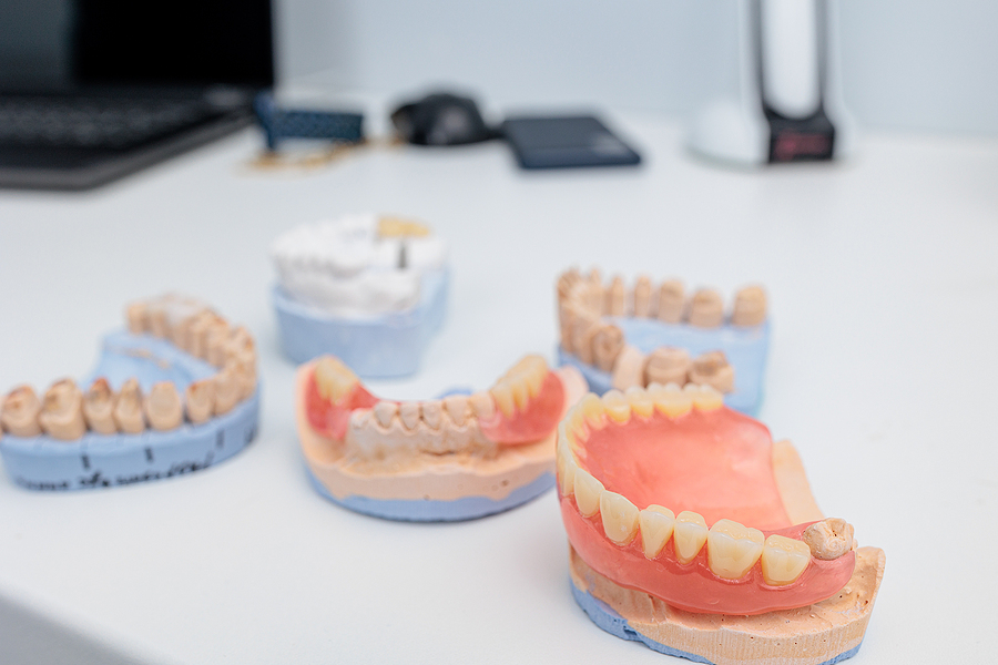 Restore Your Smile and Confidence with Quality Dentures in Tracy, CA ...