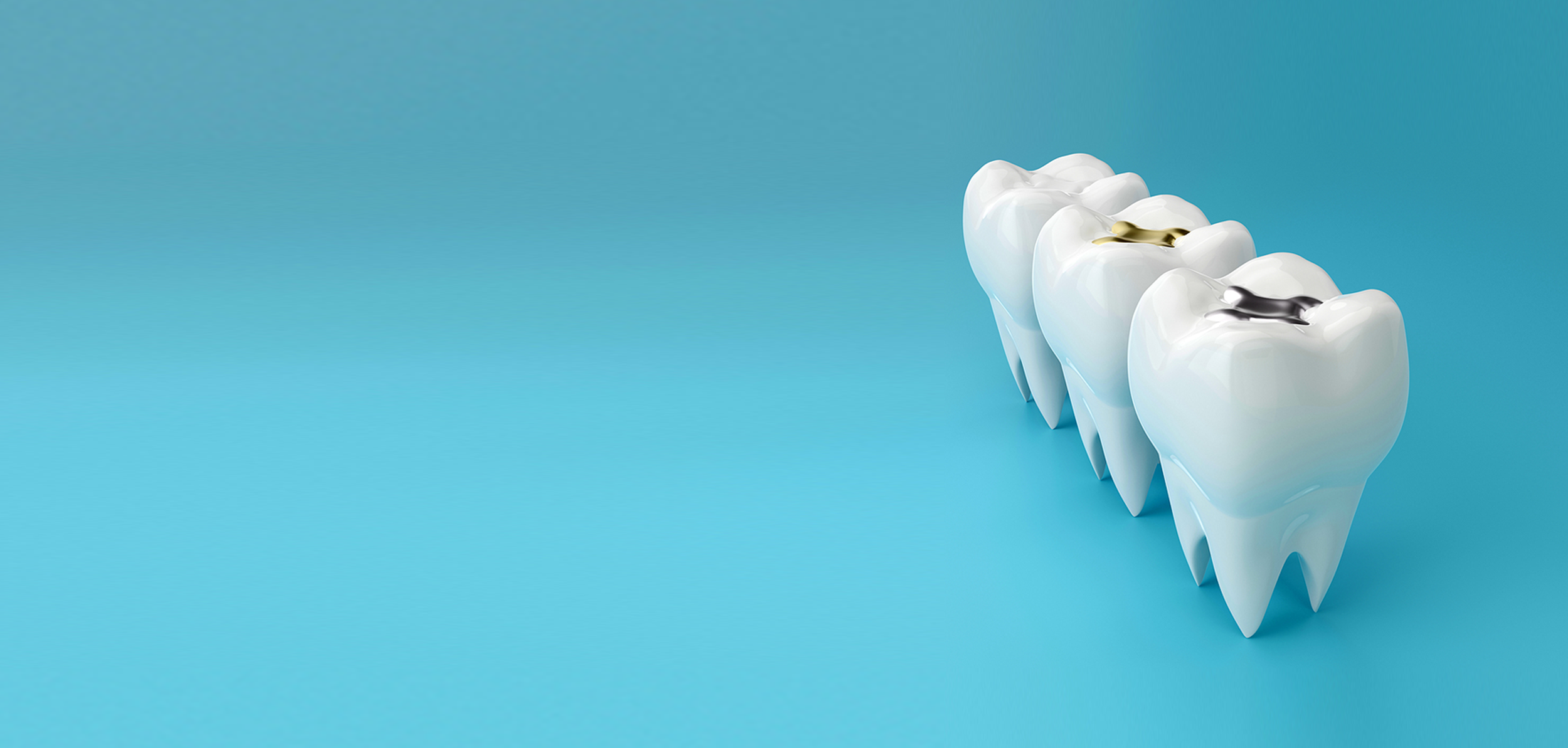 Post Operative Instructions – Dental Fillings | Greater Dental Health ...