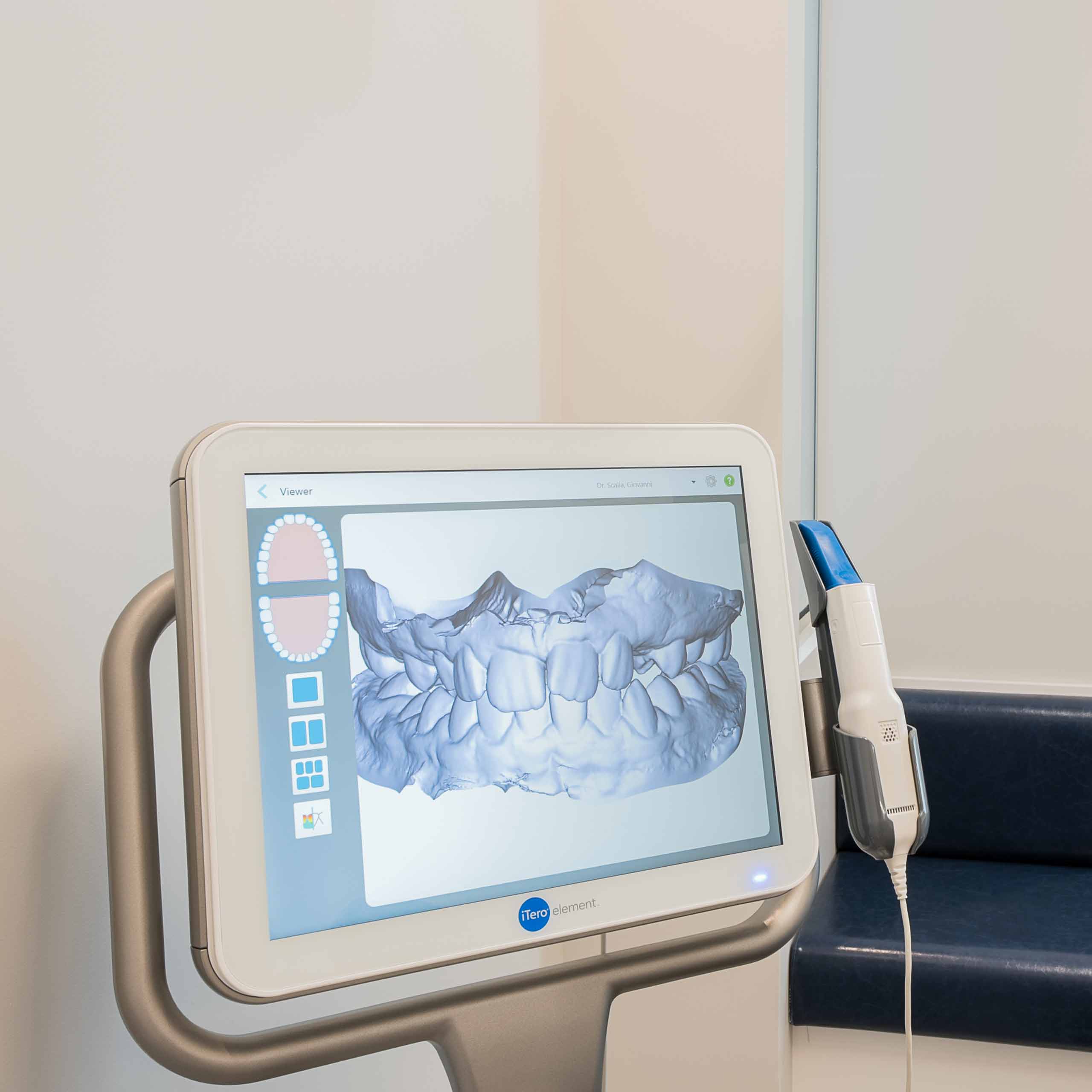 iTero® Digital Scanning | Knoxville Orthodontics