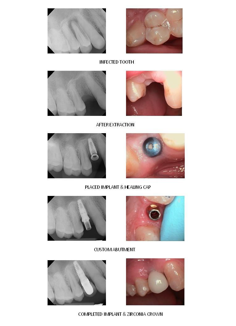 Smile Gallery | Valerie Vargas Del Rio, TX