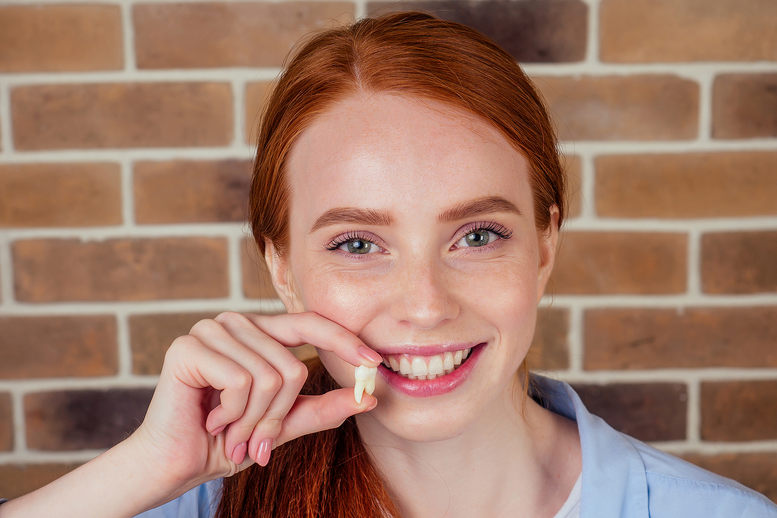 Understanding the Importance of Wisdom Teeth Removal in Federal Way, WA ...