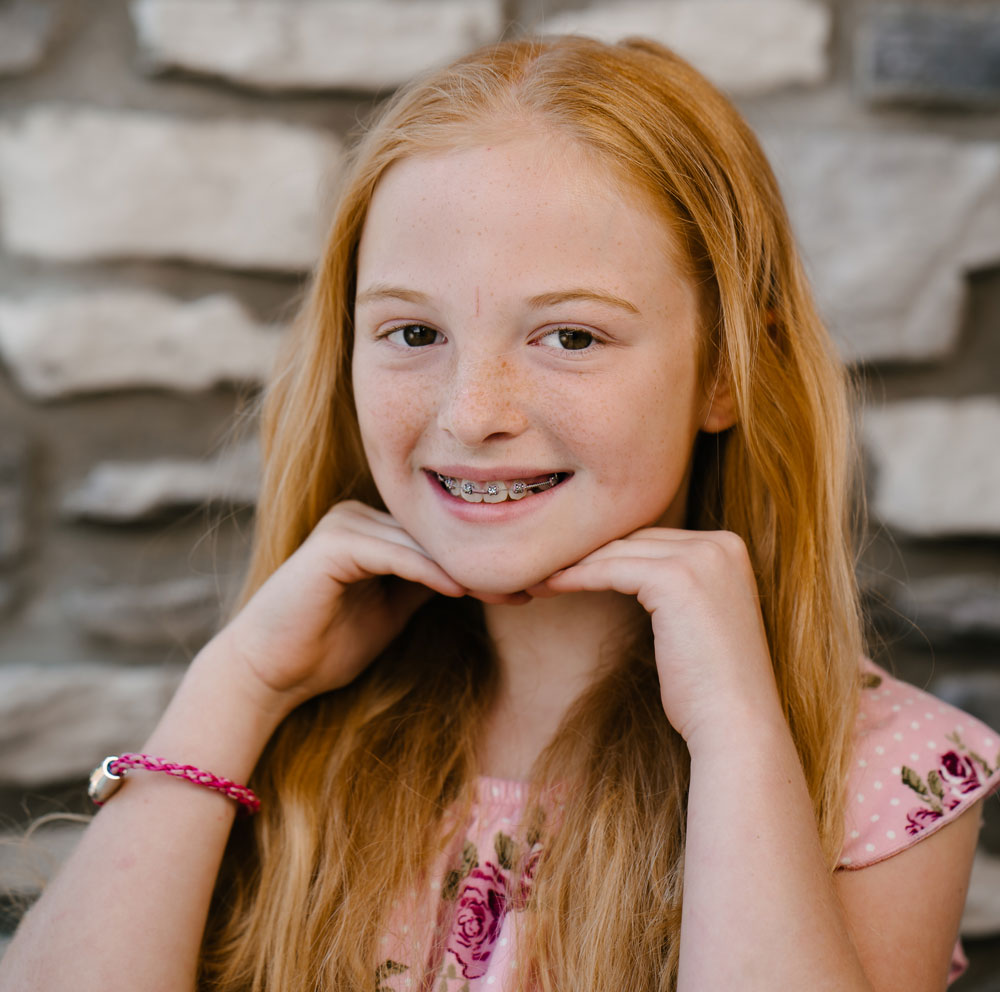 Braces (In One Day) | Lawless Orthodontics Bowling Green, KY & Glasgow ...
