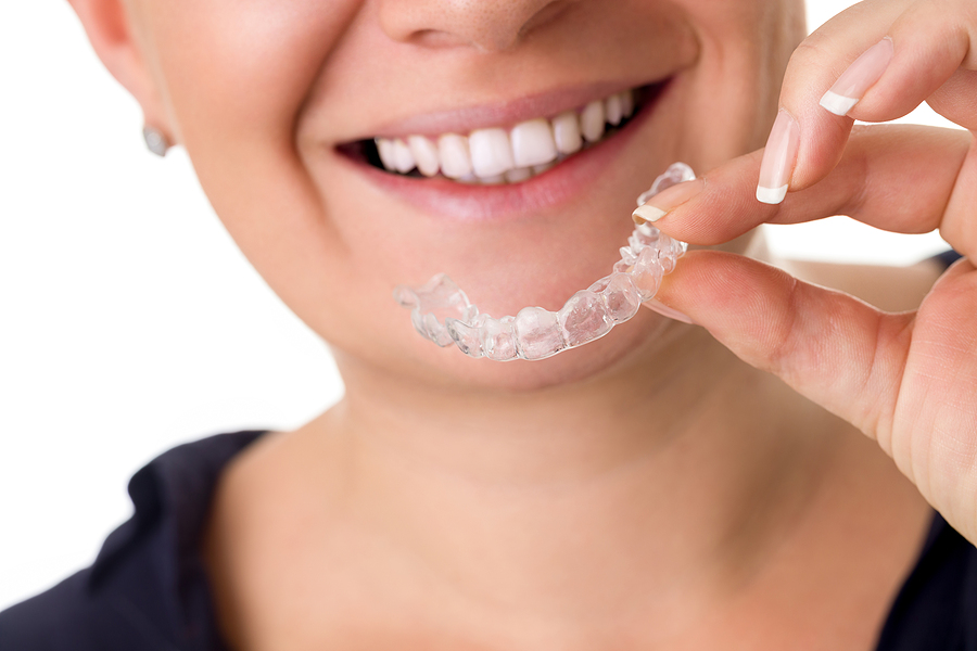 Top 5 Reasons To Choose Invisalign For Your Orthodontic Treatment
