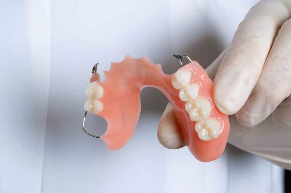 Upper Partial Dentures