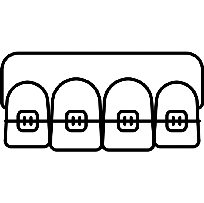 Iconix Braces | Smile 4 Less Orthodontics El Paso, TX & El Paso, TX ...