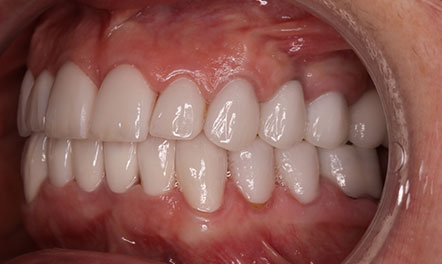 Virtual Consultation | Sublime Smiles Orthodontics Rockville, MD ...