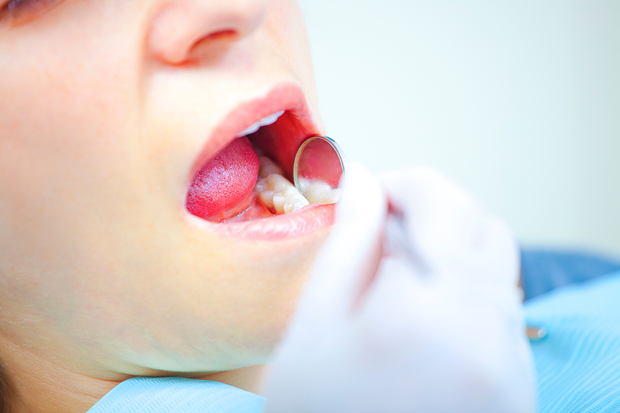 A Comprehensive Guide to Full-Mouth Reconstruction in Atlanta, GA ...