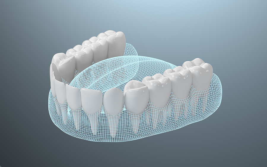 Experience the Future of Dentures with AvaDent® Digital Dentures in ...