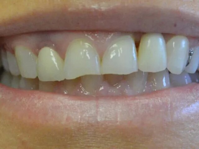 Dentist Manson, IA | Manson Dental | 50563