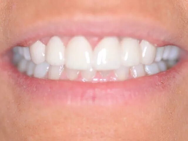 Dentist Manson, IA | Manson Dental | 50563