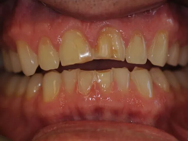 Dentist Manson, IA | Manson Dental | 50563