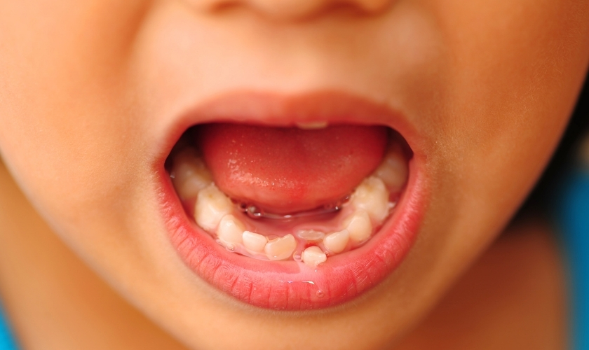 Curious About Primary Teeth? Everything You Want to Know Here!