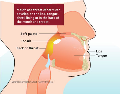 Get the Facts about Mouth and Throat Cancer | Rock Kids Dental Crofton MD