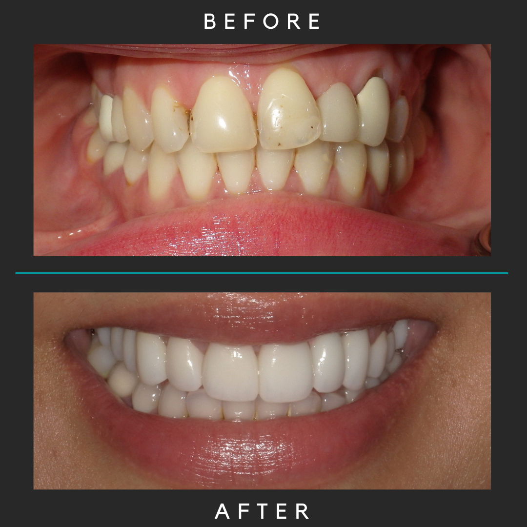 Smile Gallery | Rina Singh DDS, Camp Hill PA