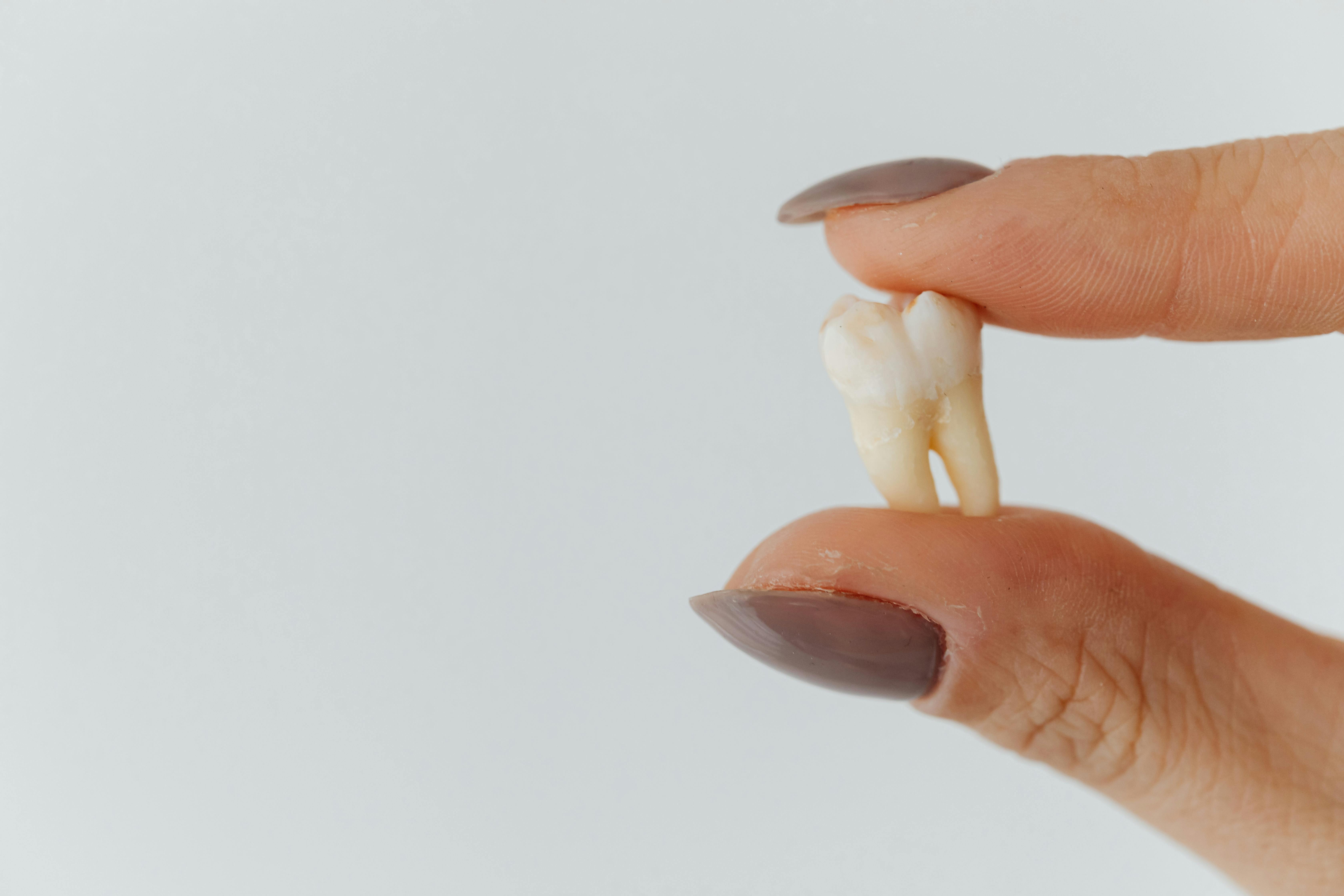 Baby Tooth Crowns in Tarzana, CA | SoCalSmiles Dental Office