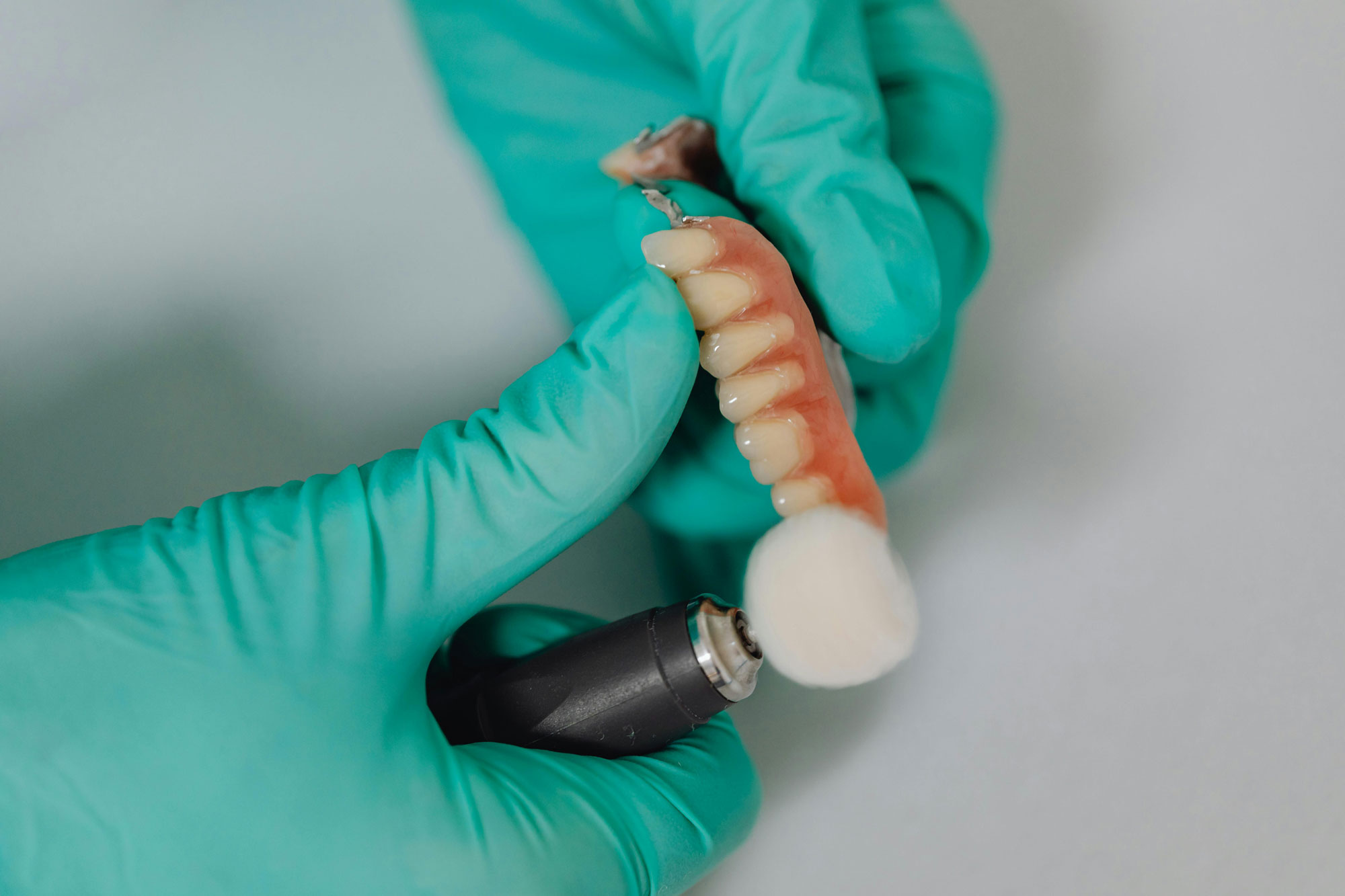 Enhance Your Implants with Bone Grafting | Q & A Dental Care