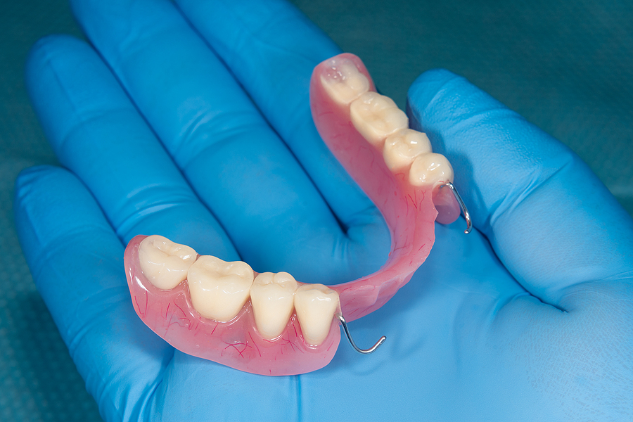 Understanding Removable Partial Dentures in Vero Beach, FL: A Comprehensive Guide | Root Dental ...